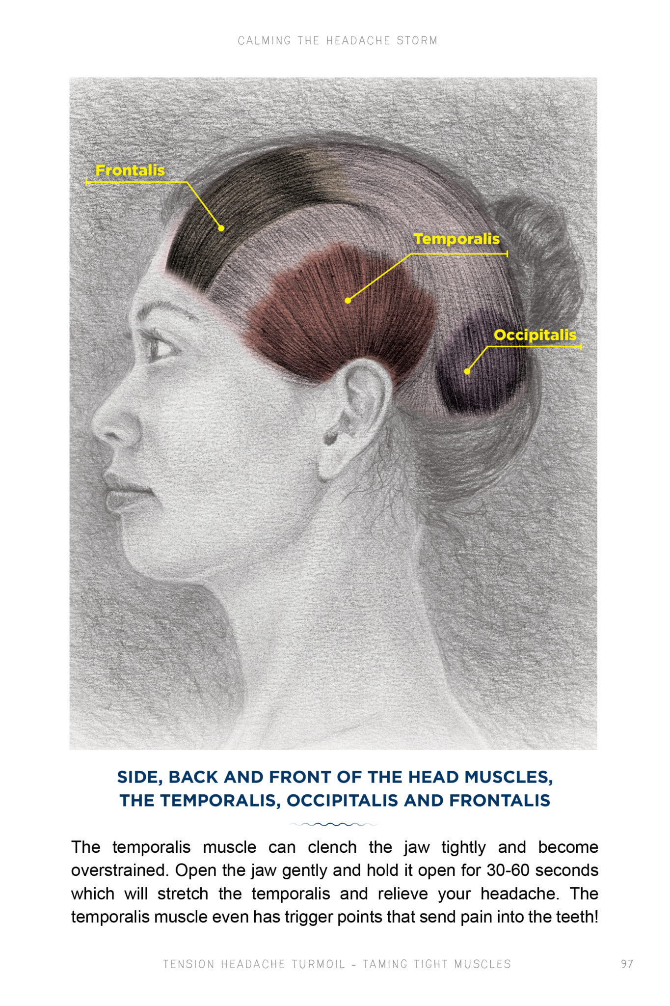 Miserable Muscle Number Three - The Temporalis Muscle. This One's the ...